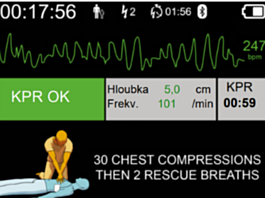 DefiSign Pocket Plus ECG-Weergave Optie | AEDwinkel.nl